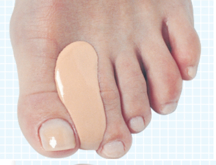 Digital Orthosis Compound - Toronto Orthotics